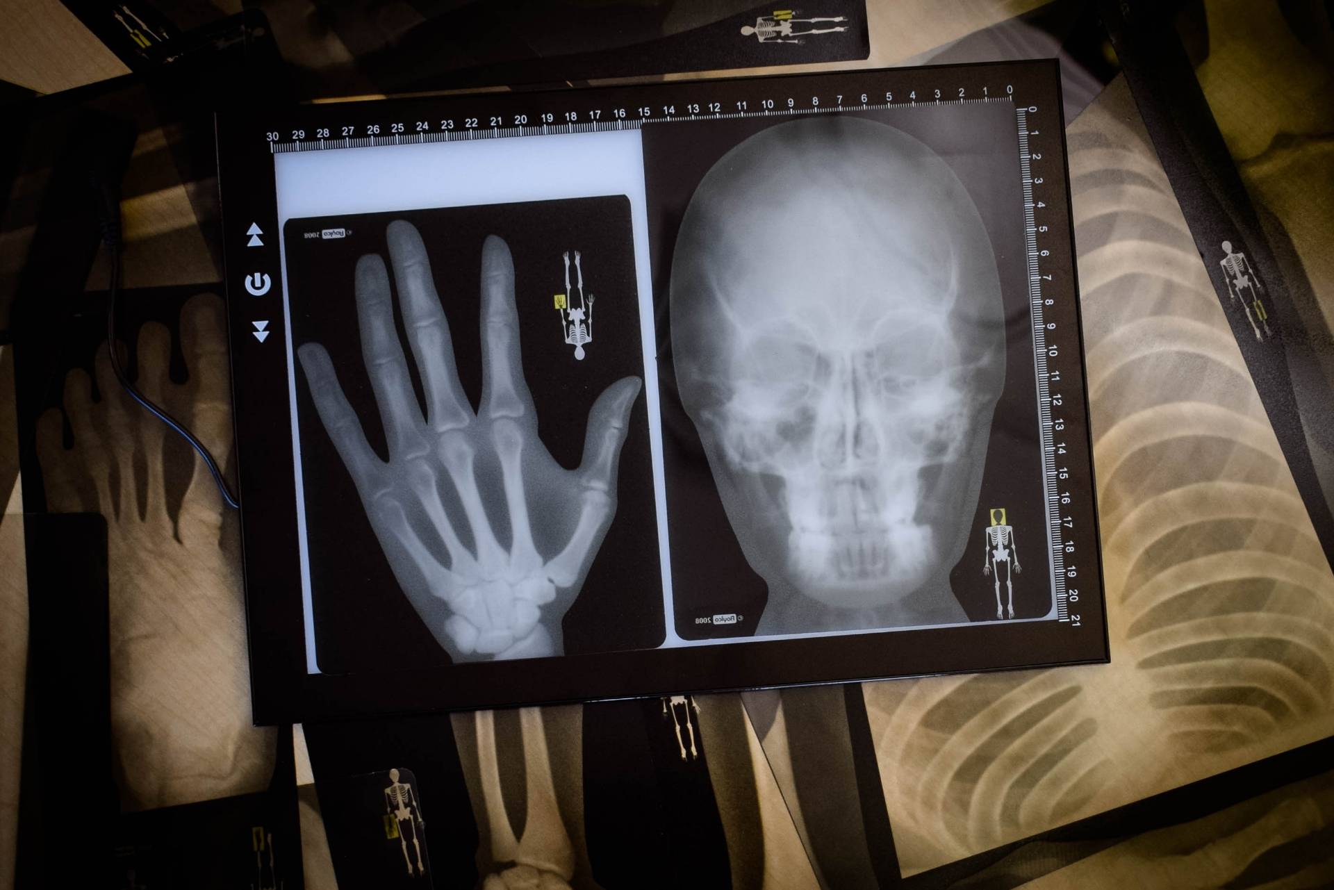 Human X-Ray Toolkit
